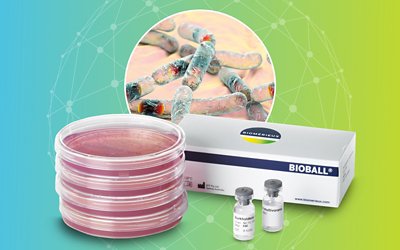 BIOBALL® Custom Services | Pioneering Diagnostics
