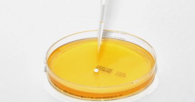 BIOBALL® | Pioneering Diagnostics