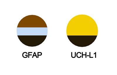 VIDAS® 3 | Pioneering Diagnostics