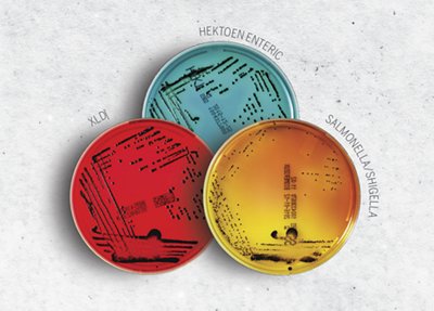 Conventional Culture Media | Pioneering Diagnostics