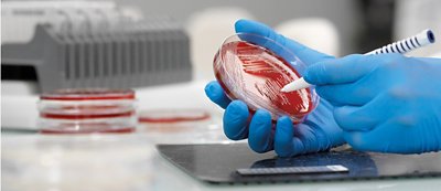 VITEK® MS PRIME | Pioneering Diagnostics