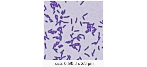 Lactobacillus Casei Gram Stain
