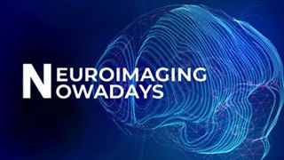 Neuroimaging Nowadays